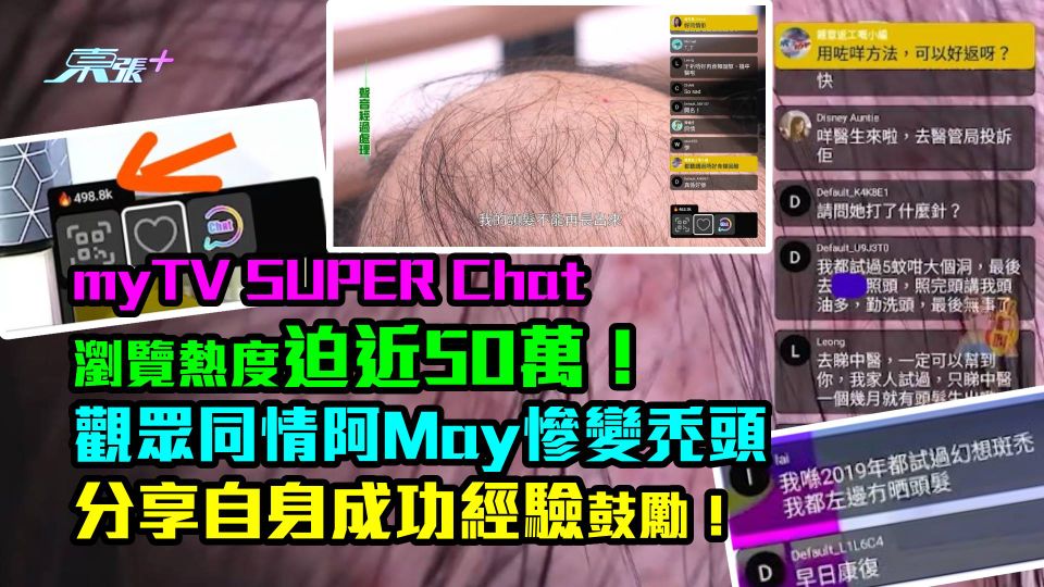 myTV SUPER Chat瀏覽熱度迫近50萬！ 觀眾同情阿May慘變禿頭紛分享自身成功經驗鼓勵！ - 東張+